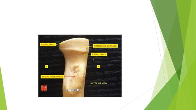 Anatomy of the Radius Bone | PPTX