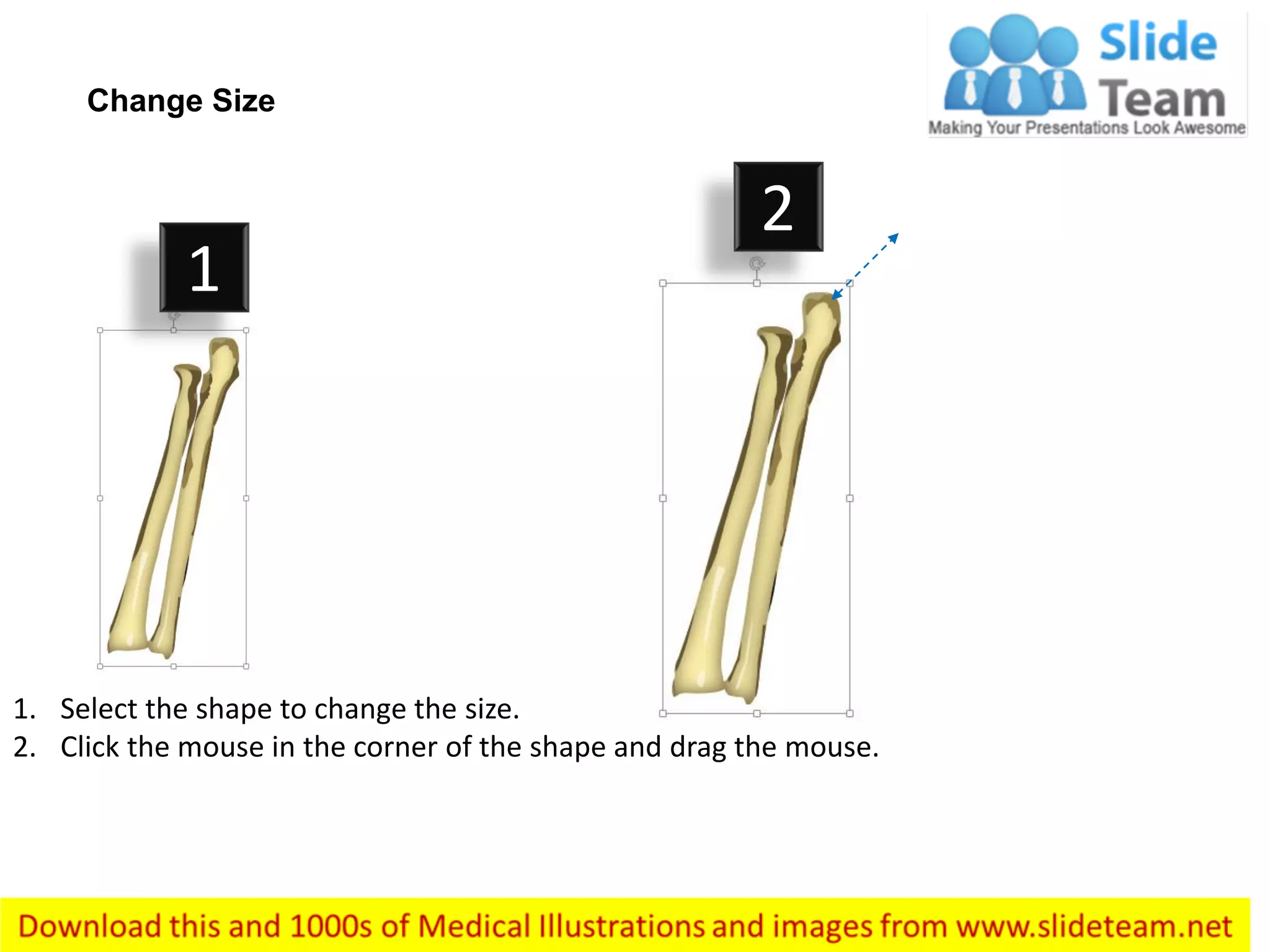 Radius posterior view medical images for power point | PDF