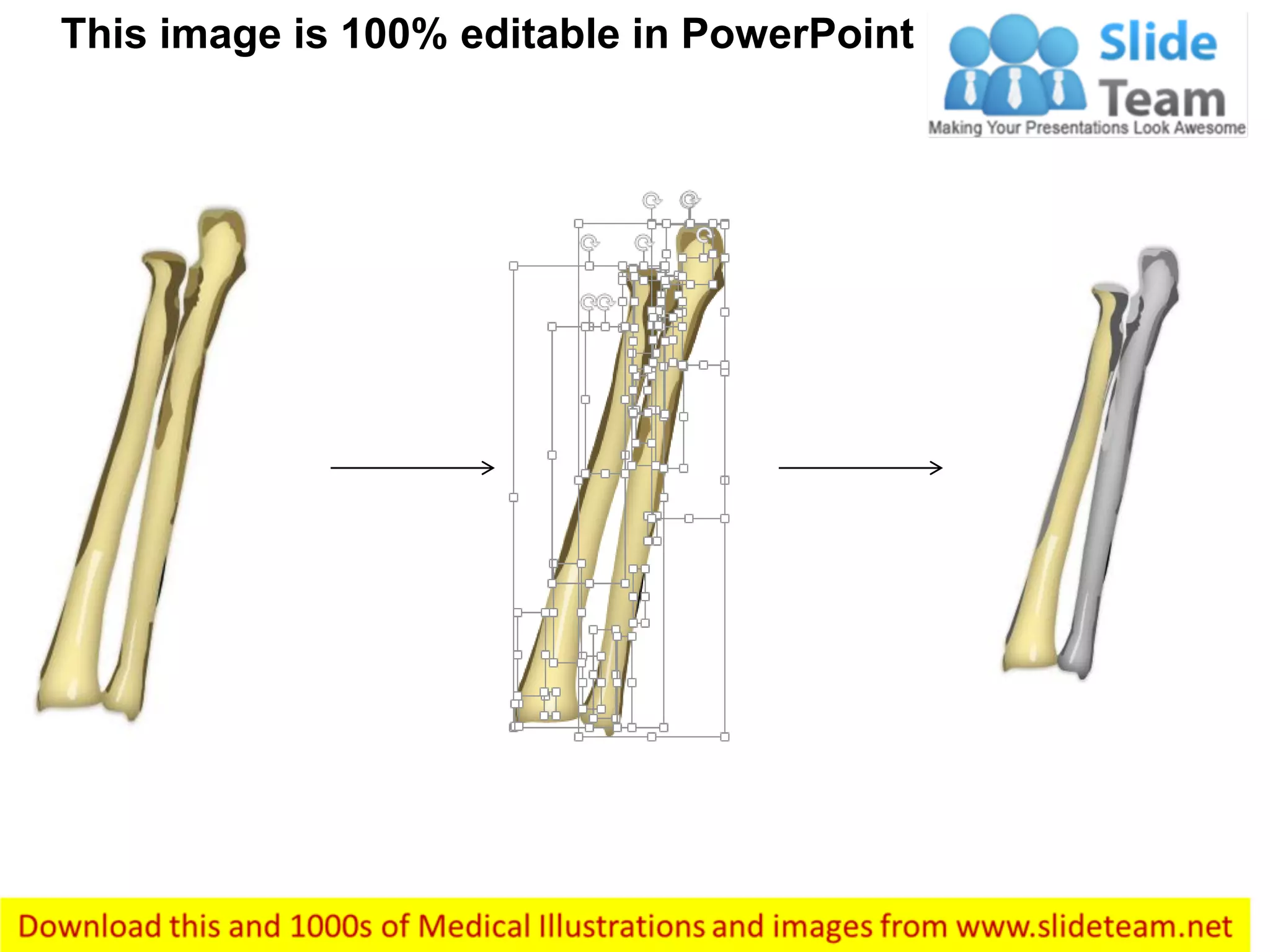 Radius posterior view medical images for power point | PDF