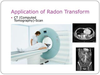 Radon Transform - image analysis | PPTX
