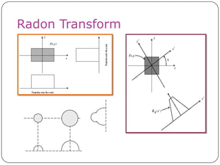 Radon Transform - image analysis | PPTX