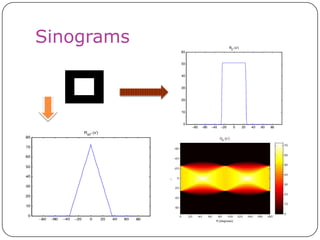 Radon Transform - image analysis | PPTX