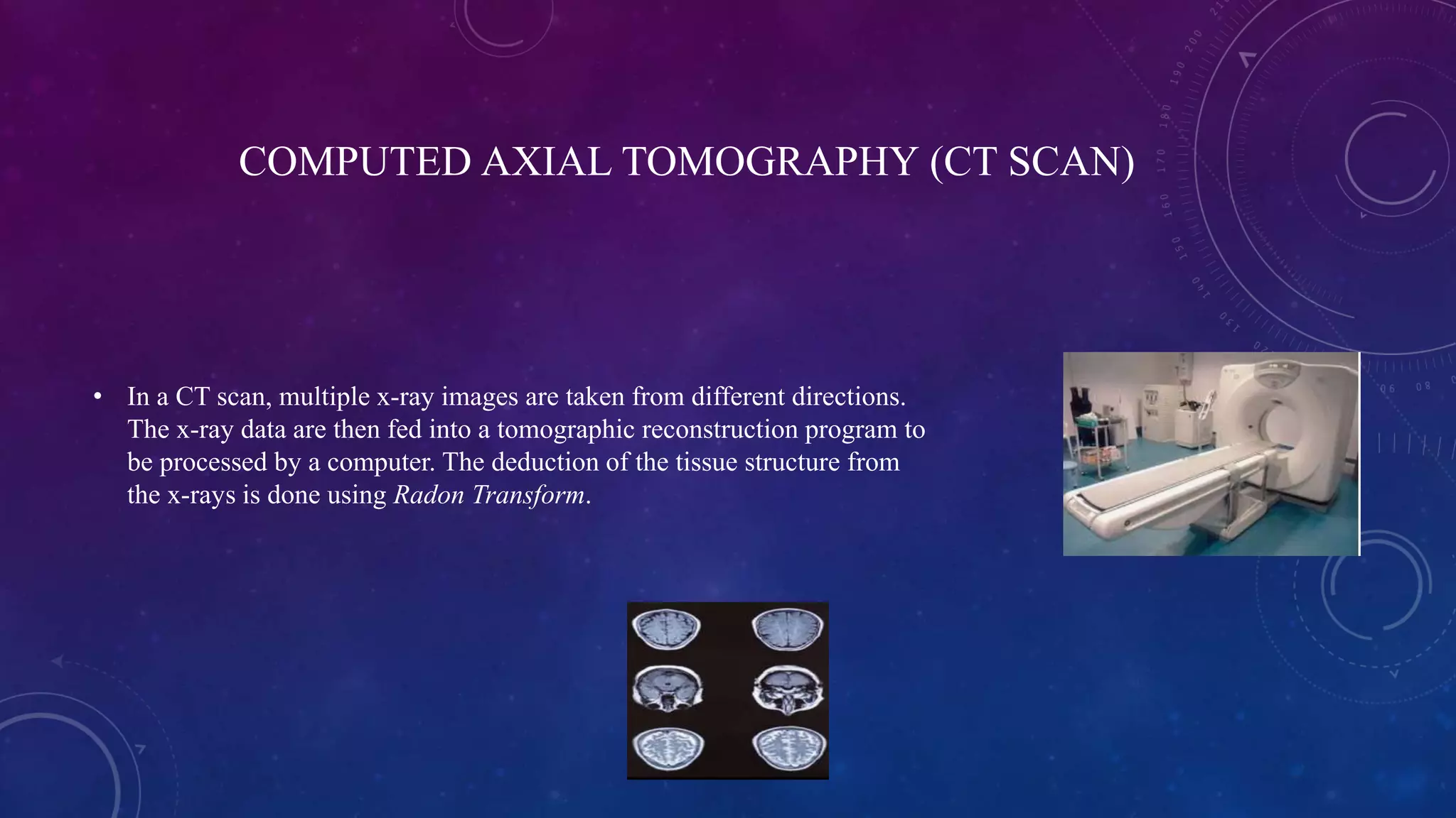 Radon transform(applications) | PPTX
