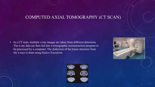Radon transform(applications) | PPTX