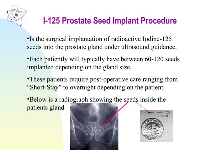 Rad Safety Inservice I 125 Prostate Seed Procedure | PPT