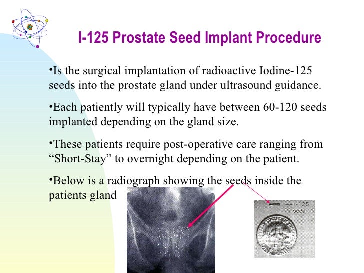 Rad Safety Inservice I 125 Prostate Seed Procedure