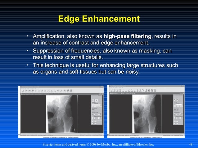 Radt 228 mod 5 ppt dig process & manipula.