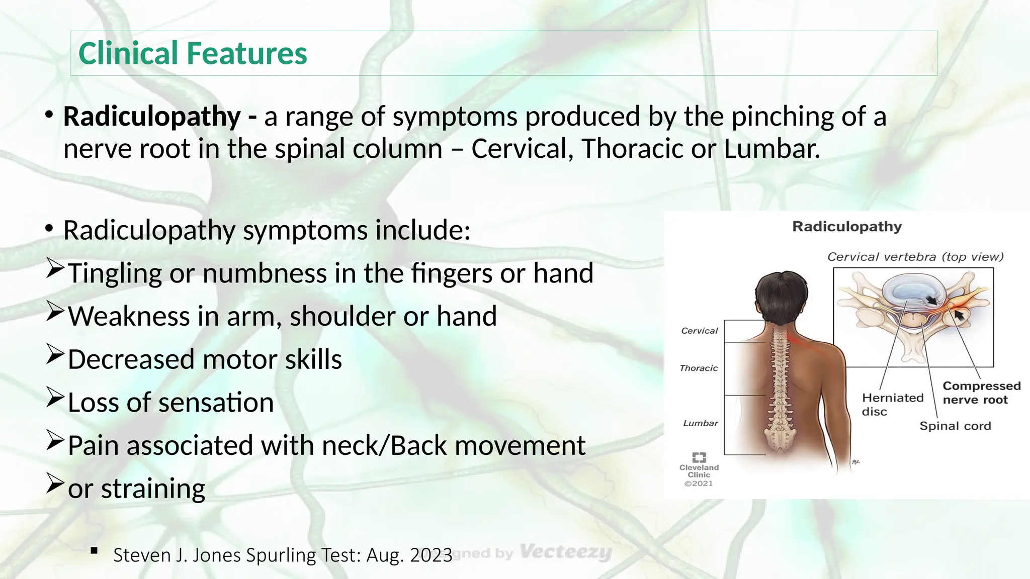 Radiculopathy Vs Neuropathy Vs Myopathy Compilation.pptx