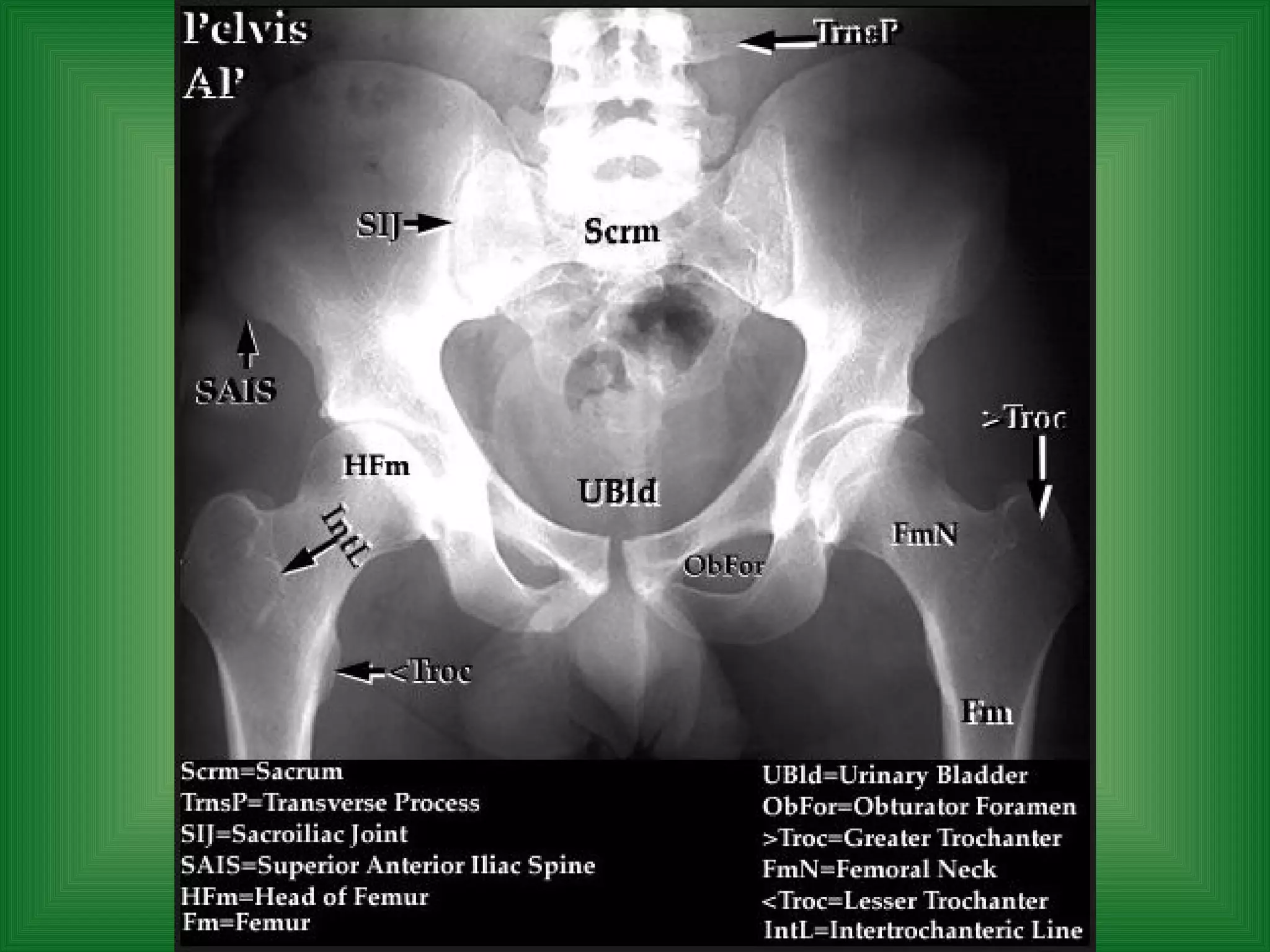 Radyolojik anatomi pelvis | PPT