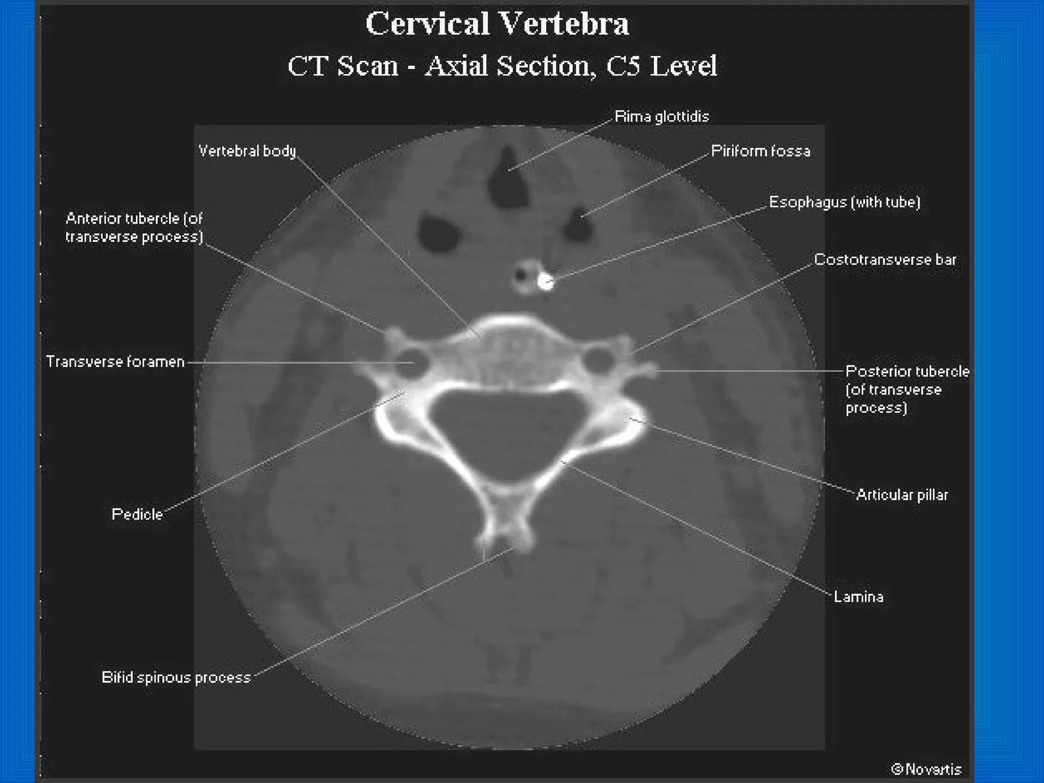 Radyolojik anatomi vertebra | PPT