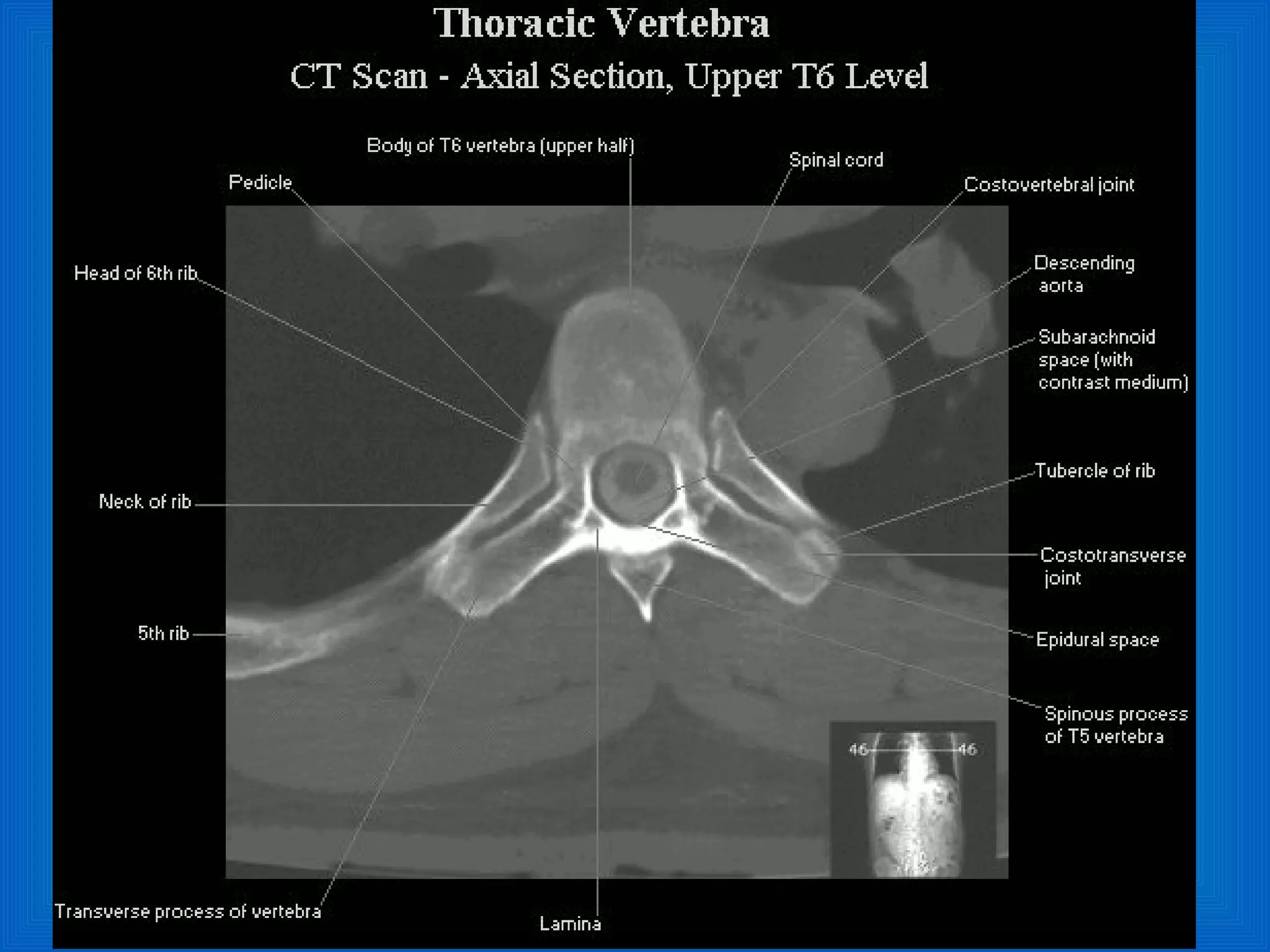 Radyolojik anatomi vertebra | PPT