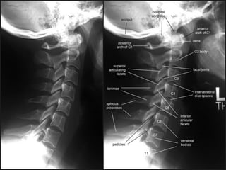 Radyolojik anatomi vertebra | PPT