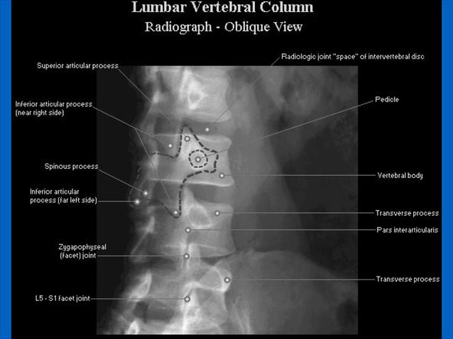 Radyolojik anatomi vertebra | PPT