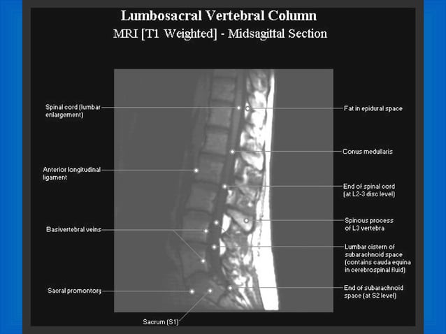 Radyolojik anatomi vertebra | PPT