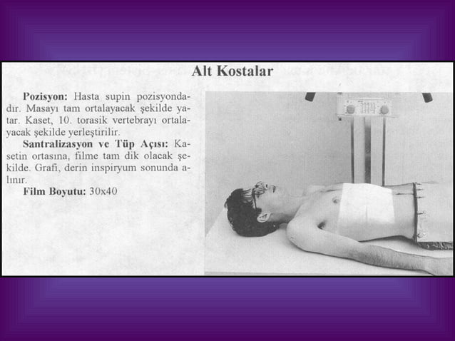 Radyolojik pozisyonlar toraks | PPT