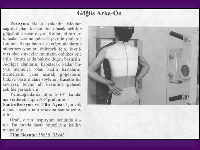 Radyolojik pozisyonlar toraks | PPT