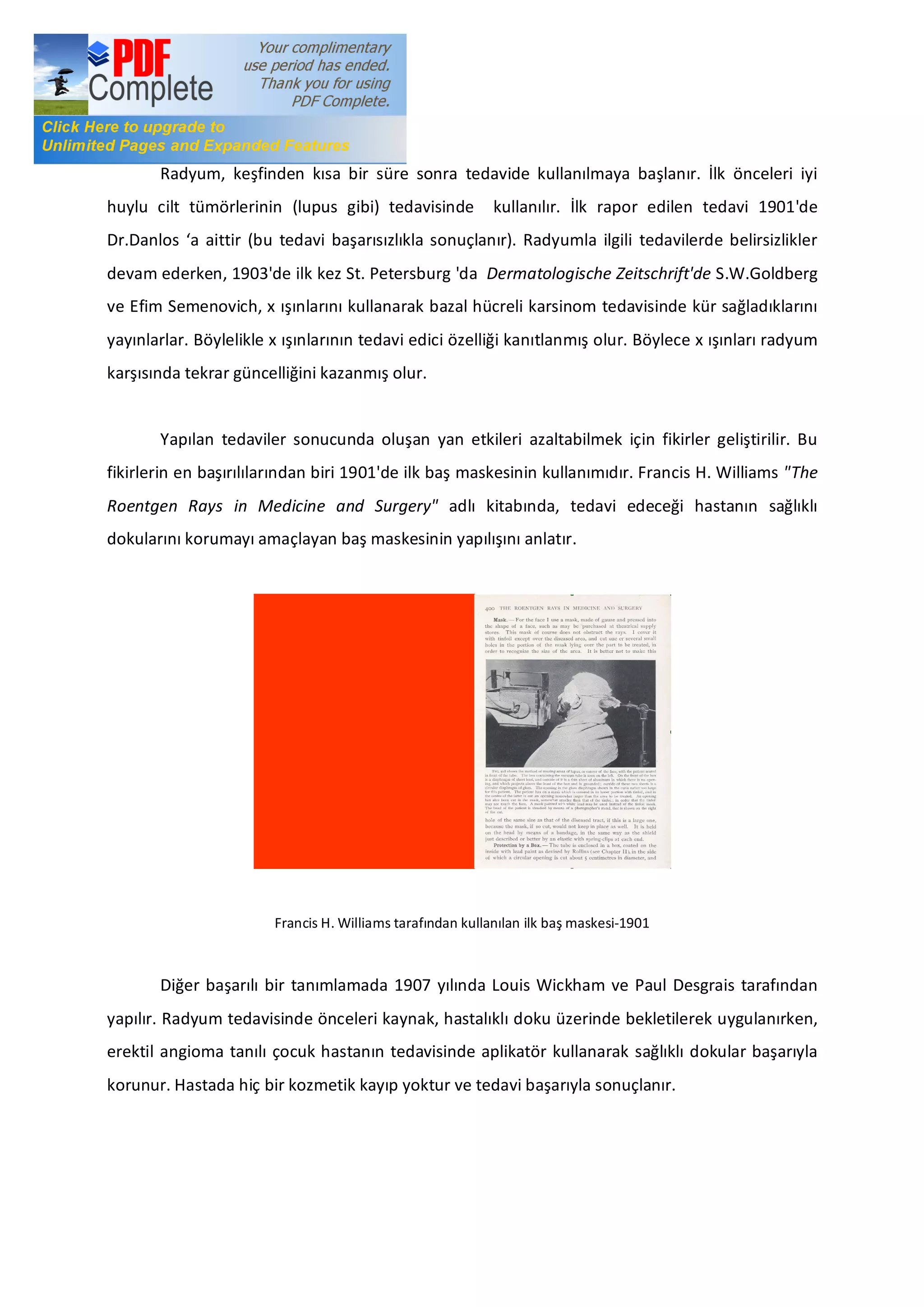 Radyoterapi Tarihce-Ozgehan Onay | PDF