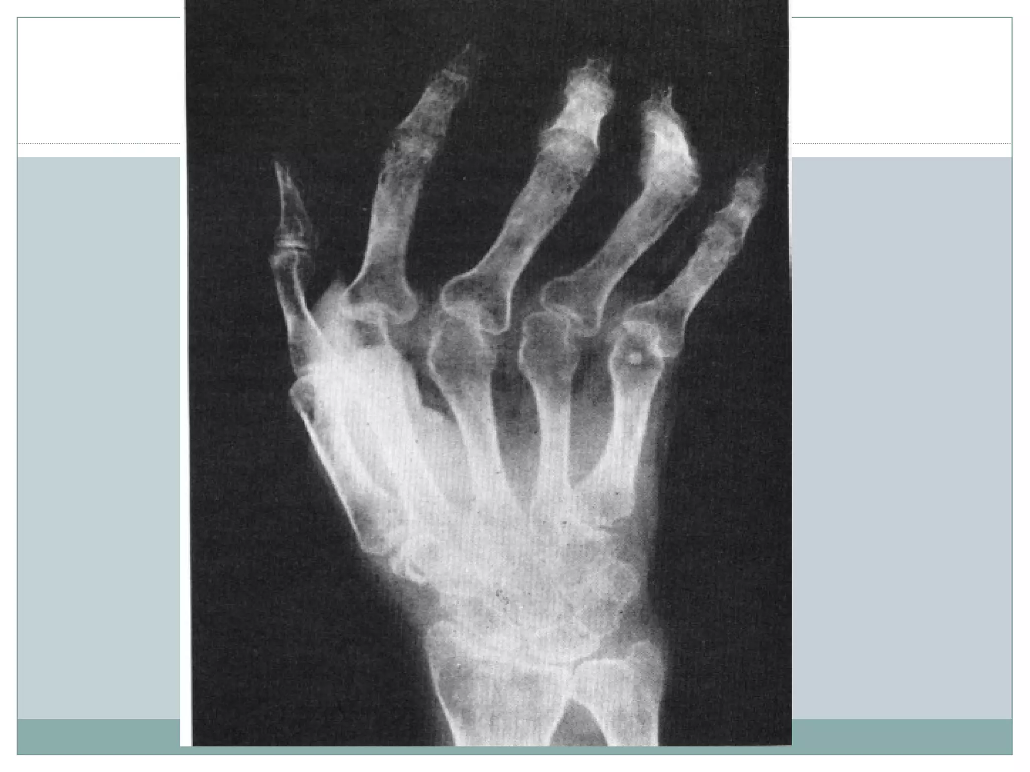 Ra hand | PPT