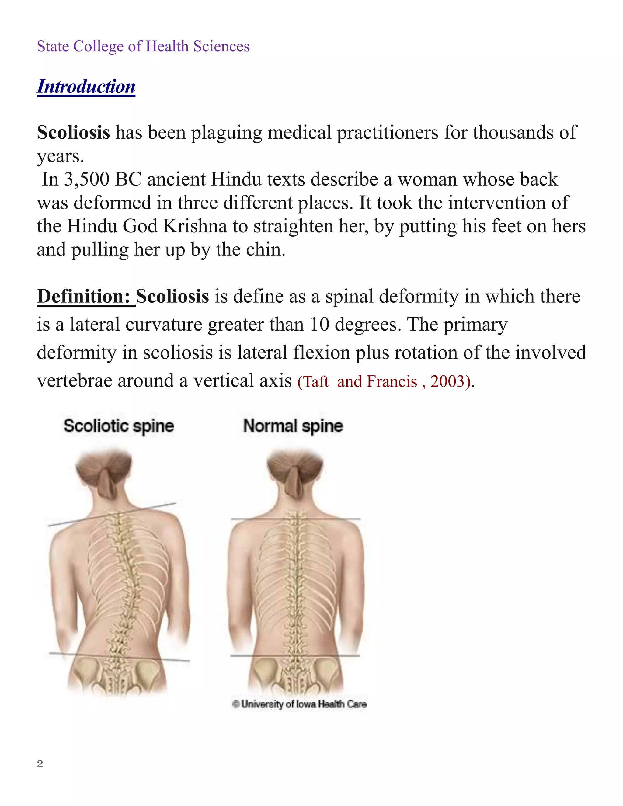 SCOLIOSIS - Presentation on SCOLIOSIS .doc