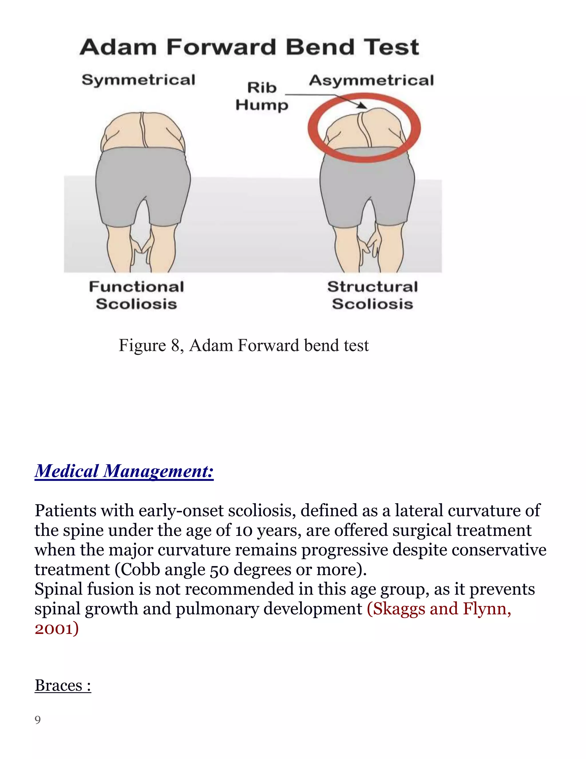 SCOLIOSIS - Presentation on SCOLIOSIS .doc
