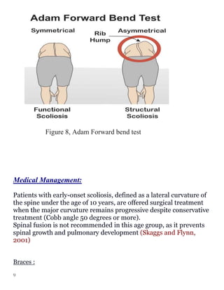 SCOLIOSIS - Presentation on SCOLIOSIS .doc | Physical Therapy | Wellness