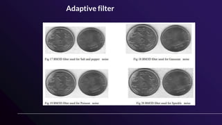 Noise Models Ultrasound | PPT