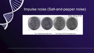 Noise Models Ultrasound | PPT