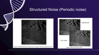 Noise Models Ultrasound | PPT