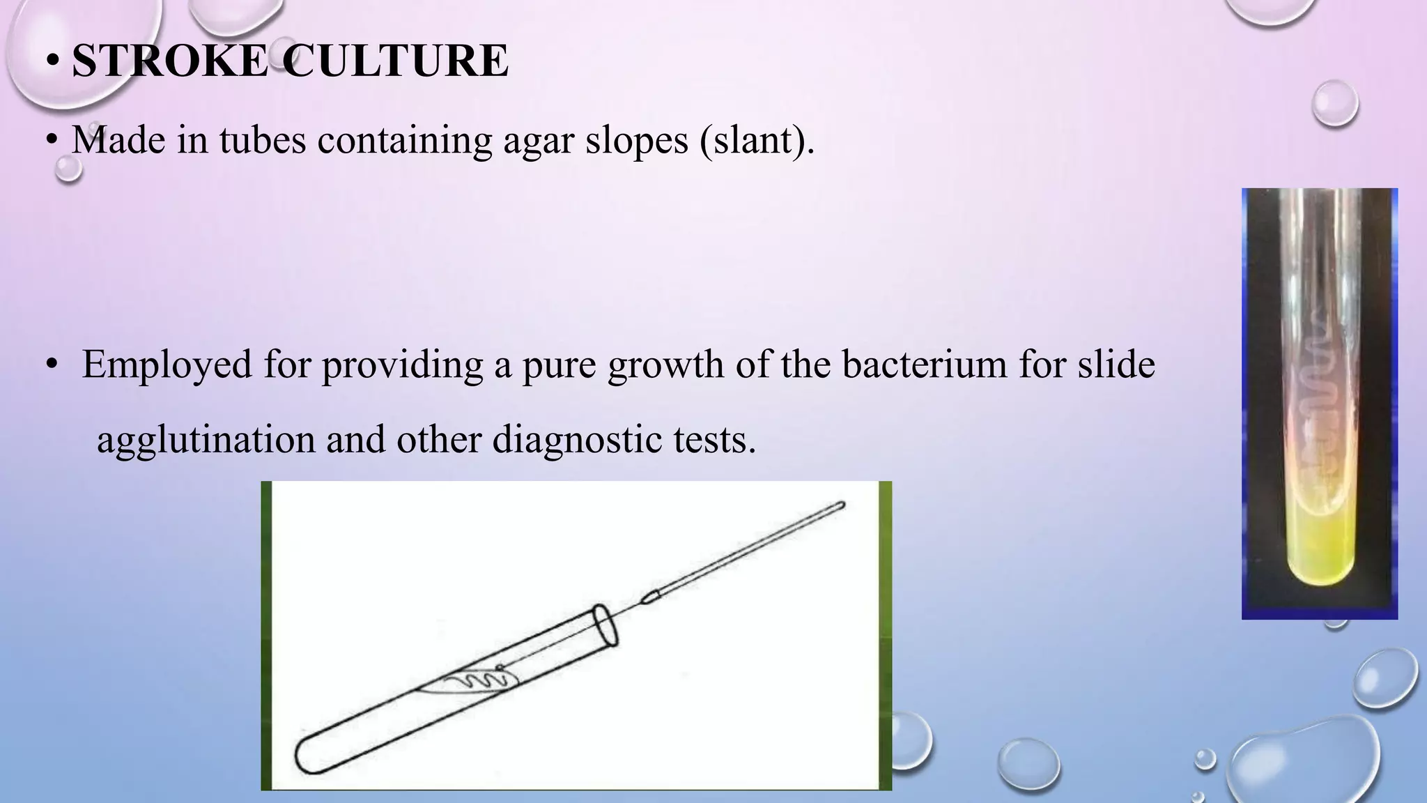 MICROBIOLOGICAL TESTS (CONVENTIONAL METHODS ) | PPTX