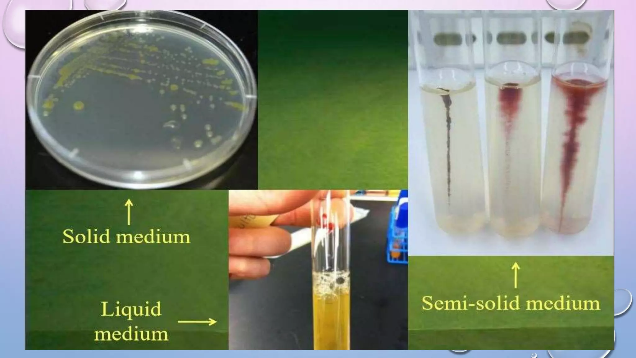 MICROBIOLOGICAL TESTS (CONVENTIONAL METHODS ) | PPTX