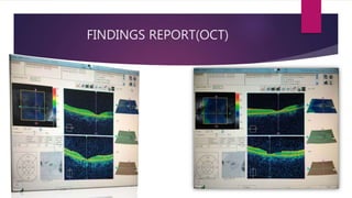 LOW VISION CASE PRESENTATION | PPTX