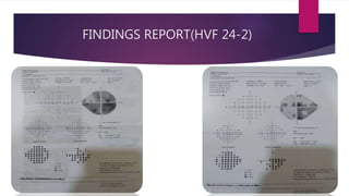 LOW VISION CASE PRESENTATION | PPTX