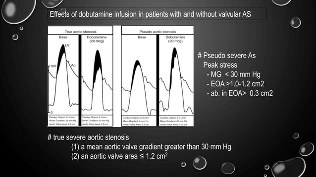 hemodynamic in cath lab: aortic stenosis and hocm | PPTX | Heart and ...
