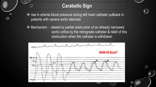 hemodynamic in cath lab: aortic stenosis and hocm | PPTX