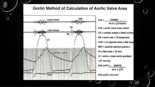 hemodynamic in cath lab: aortic stenosis and hocm