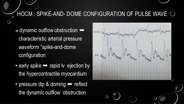 hemodynamic in cath lab: aortic stenosis and hocm