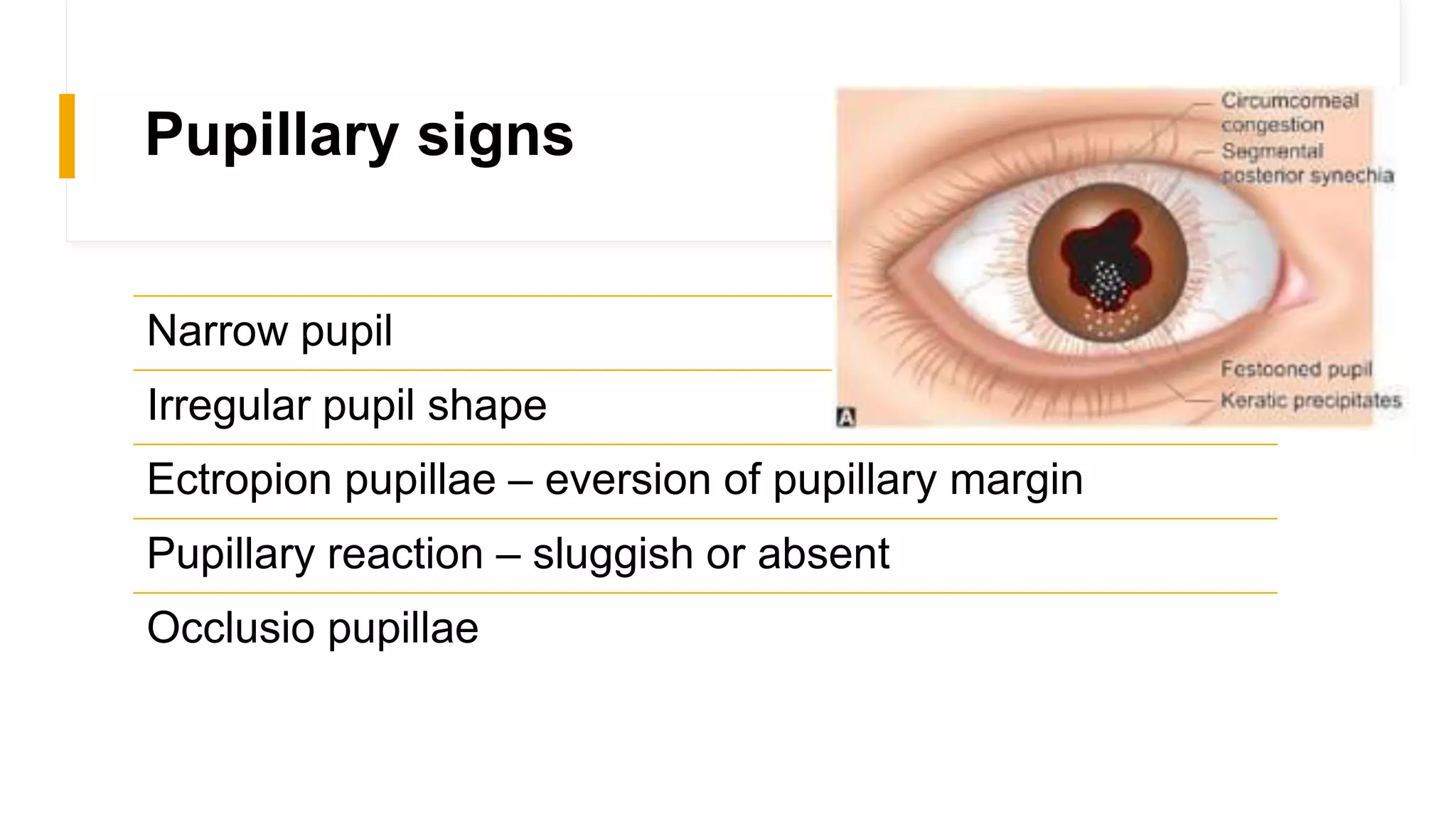 Uveitis Clinical features | PPTX