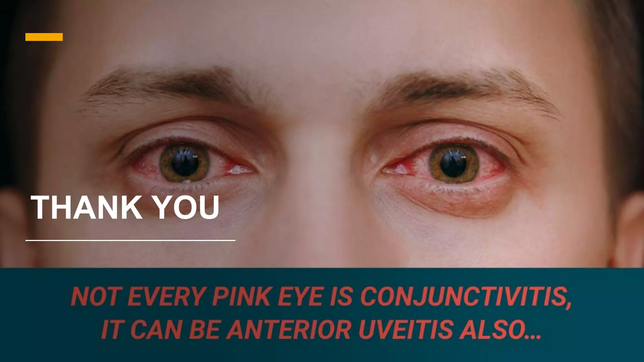 Uveitis Clinical features | PPTX