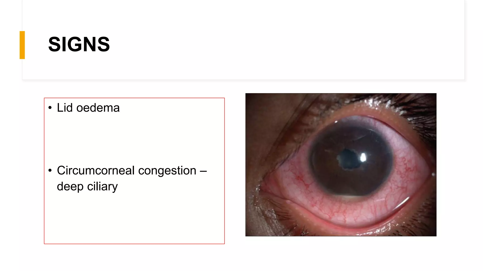 Uveitis Clinical features | PPTX