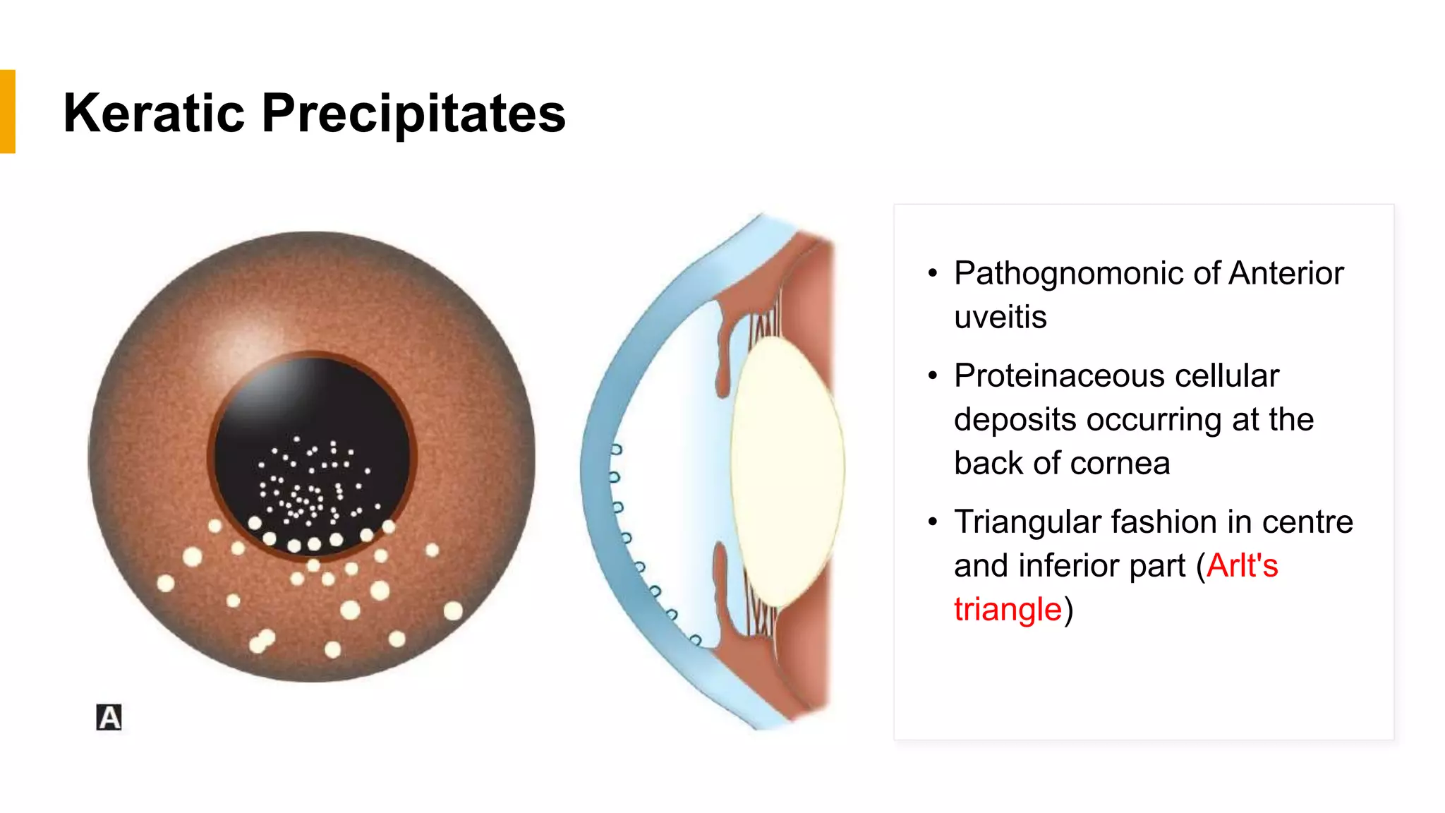 Uveitis Clinical features | PPTX