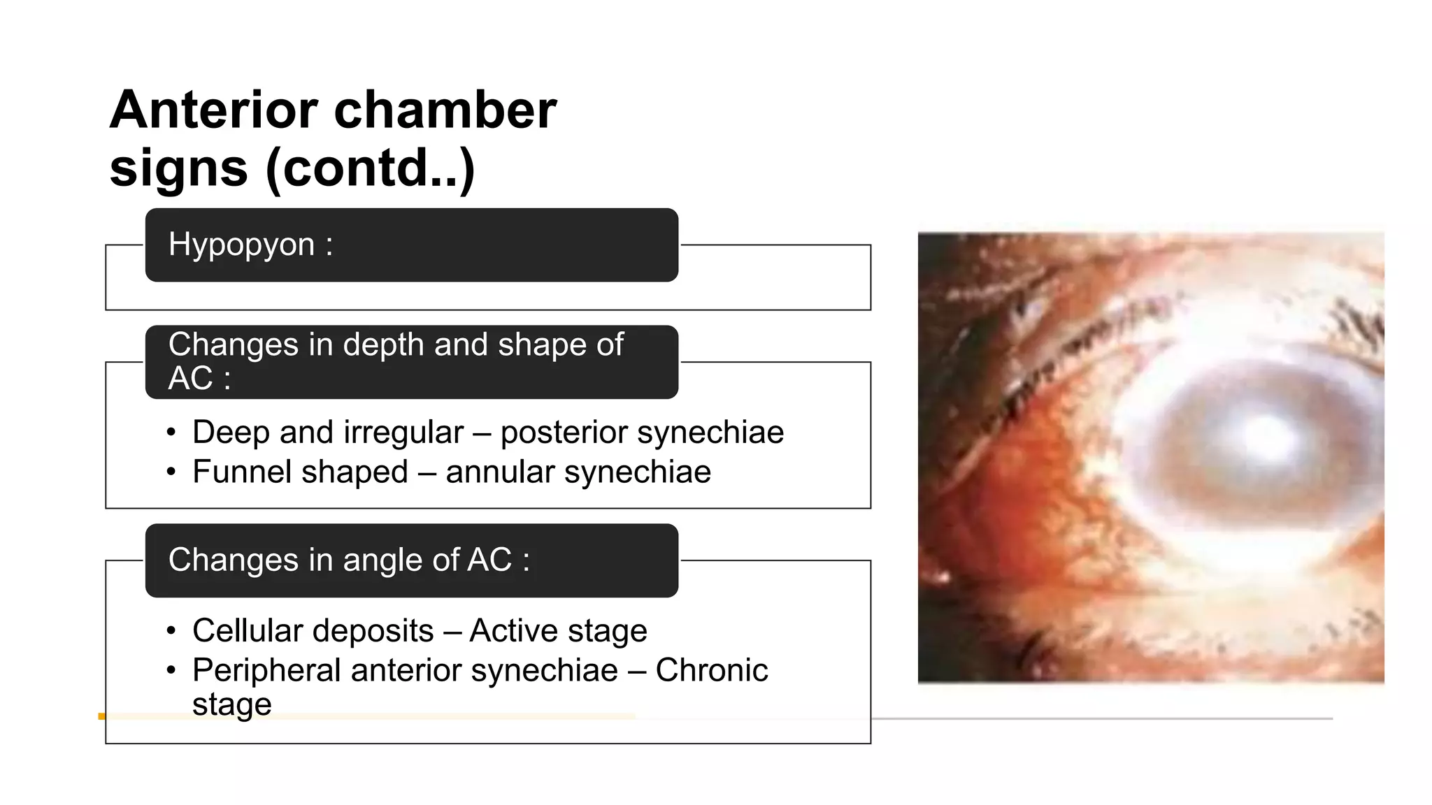 Uveitis Clinical features | PPTX