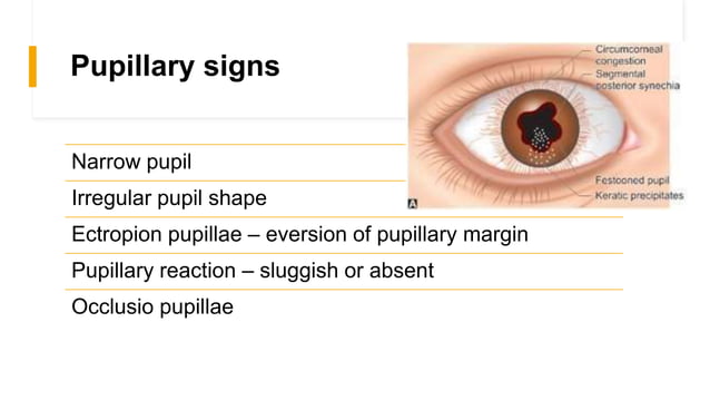 Uveitis Clinical features | PPT