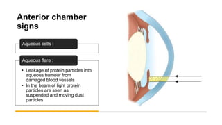 Uveitis Clinical features | PPT