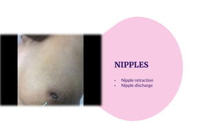 Surgery ppt.pptxhajajajajajajajjajjaajjajajaj | PPT