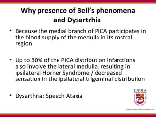 Right AICA PICA stroke | PPT