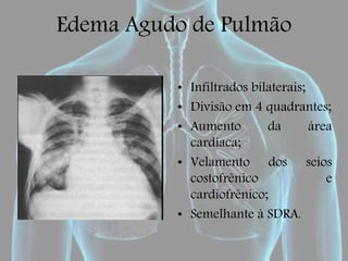 Raio x pós graduação | PPT