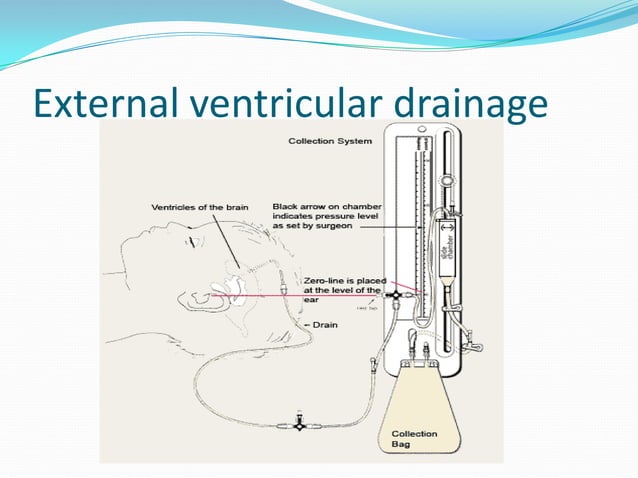 Raised Intracranial Pressure | PPTX