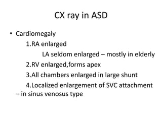 X-Ray - ASD | PPTX