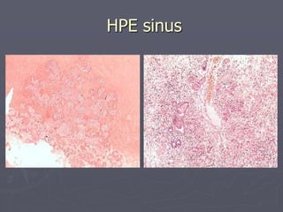 Case Presentation 1 ICU | PPSX