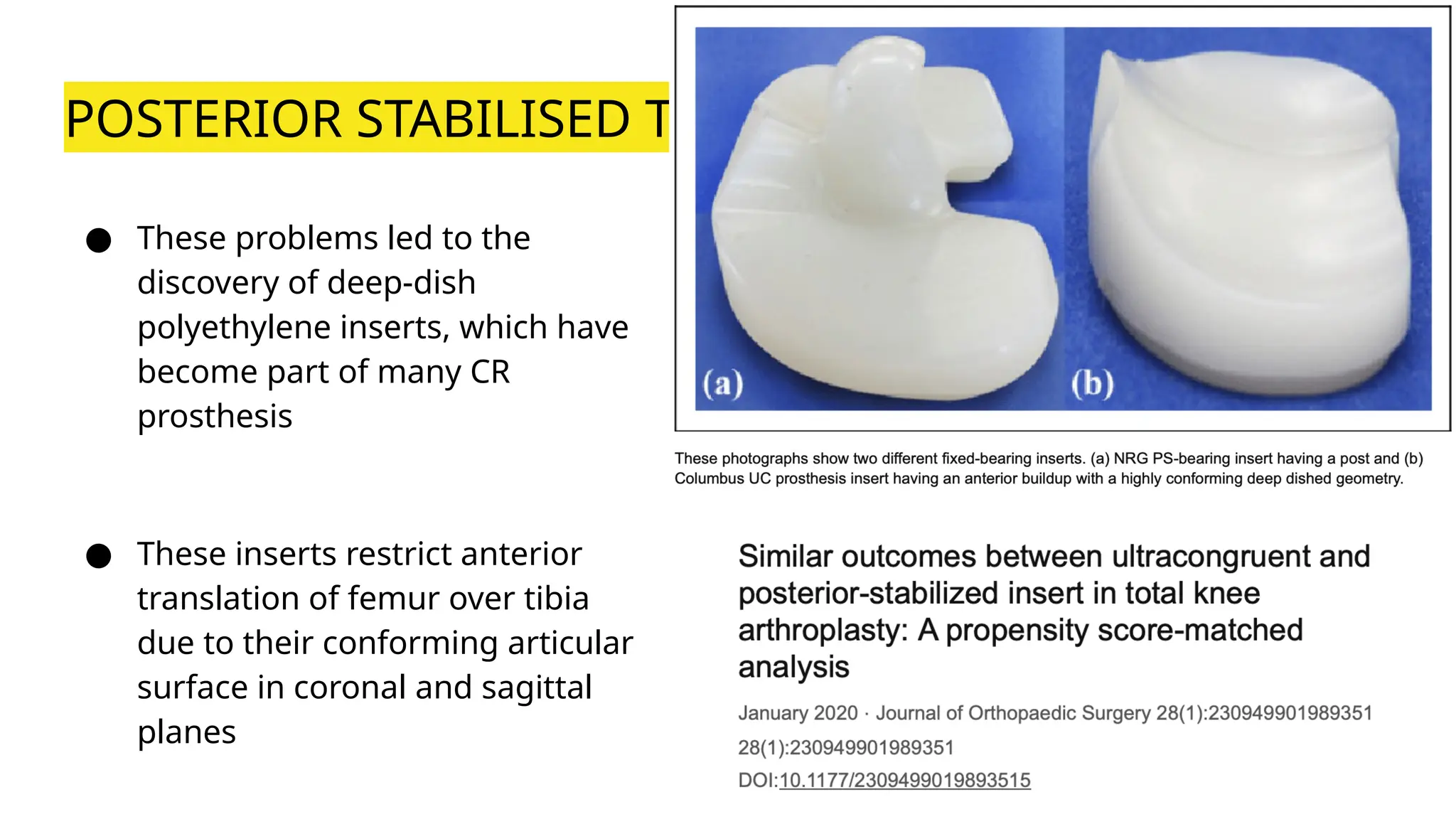 Rajagiri Evolution of Total Knee Arthroplasty design.pptx